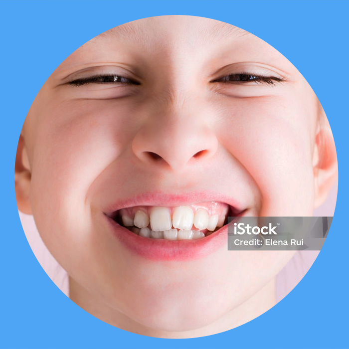 Crooked Teeth | Cumberland Dental | Dental Treatments