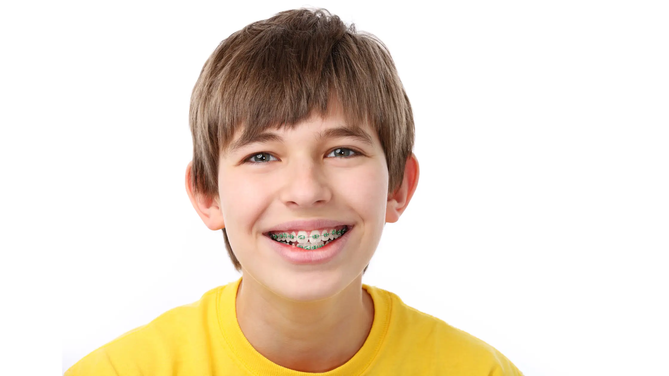 The Ultimate Guide to Braces for Kids: What Parents Need to Know ...
