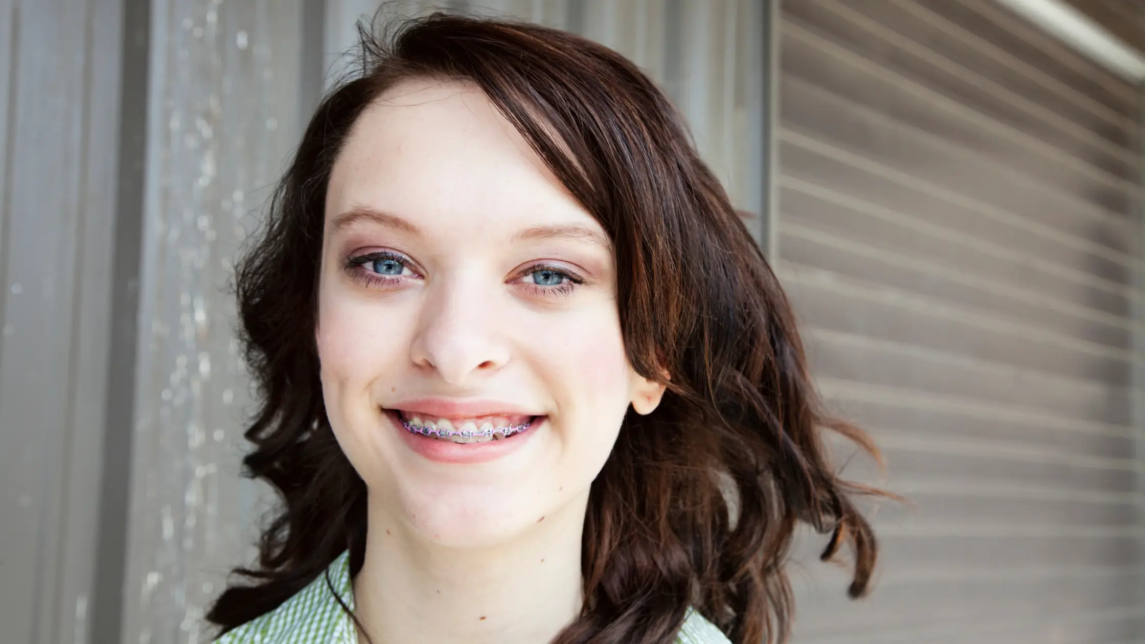 Unlocking Your Best Smile: How Braces Can Transform Teen Teeth ...